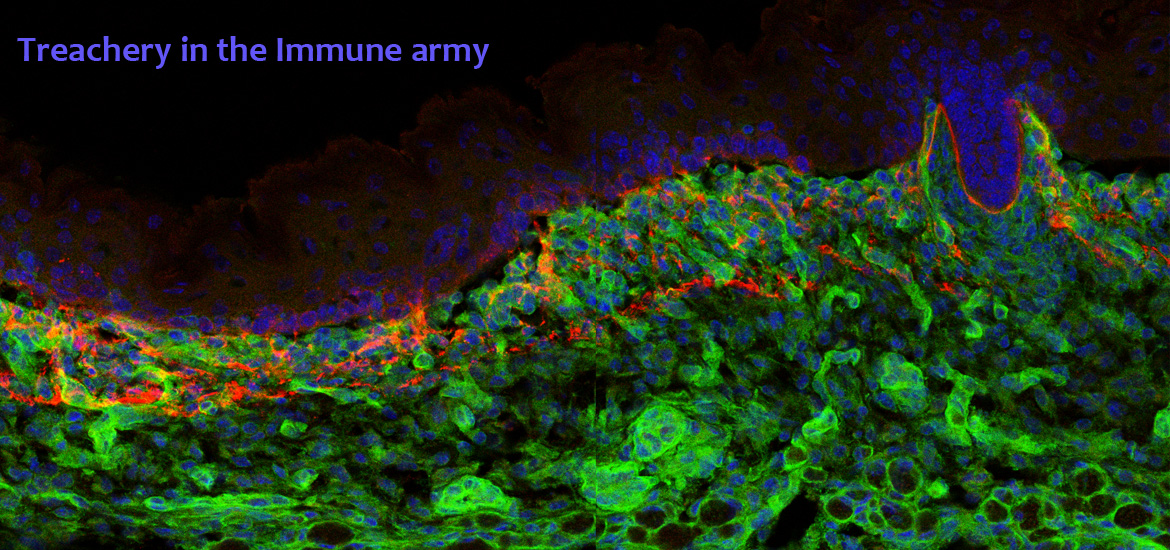 Treachery in the immune army - inStem